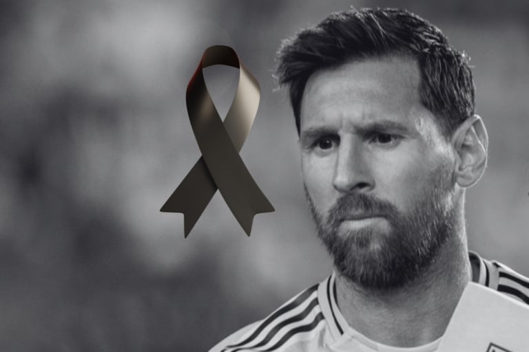 Did Lionel Messi have cosmetic surgery before the World Cup?